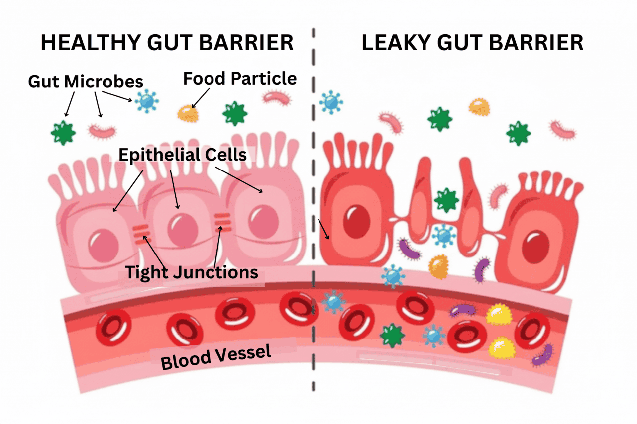 Intestinal Permeability: What Leaky Gut Really Is (and Isn’t) - Terri ...